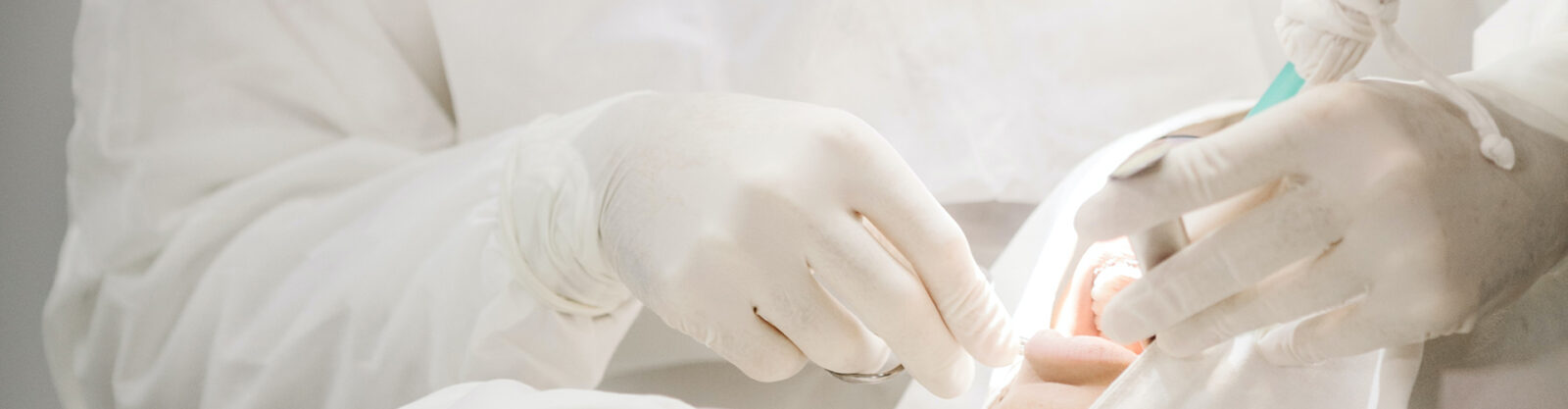 Fast Tooth Extraction Near Me Walk-In Options - openaccessmanifesto