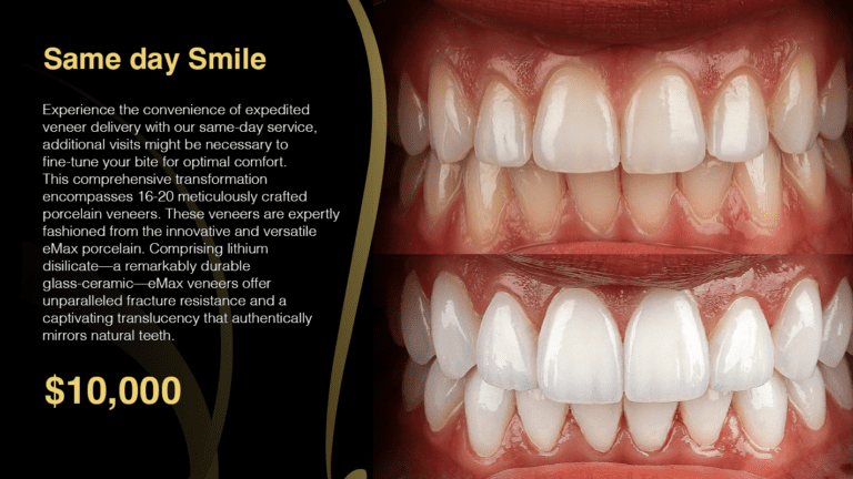 Deluxe Smile Design